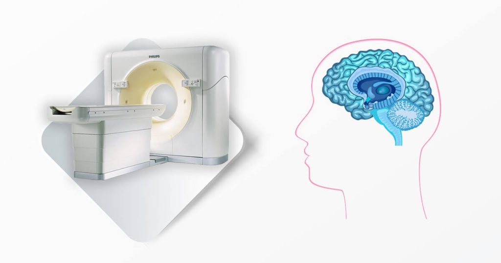 MSCT glave | Multislajsni skener Kragujevac